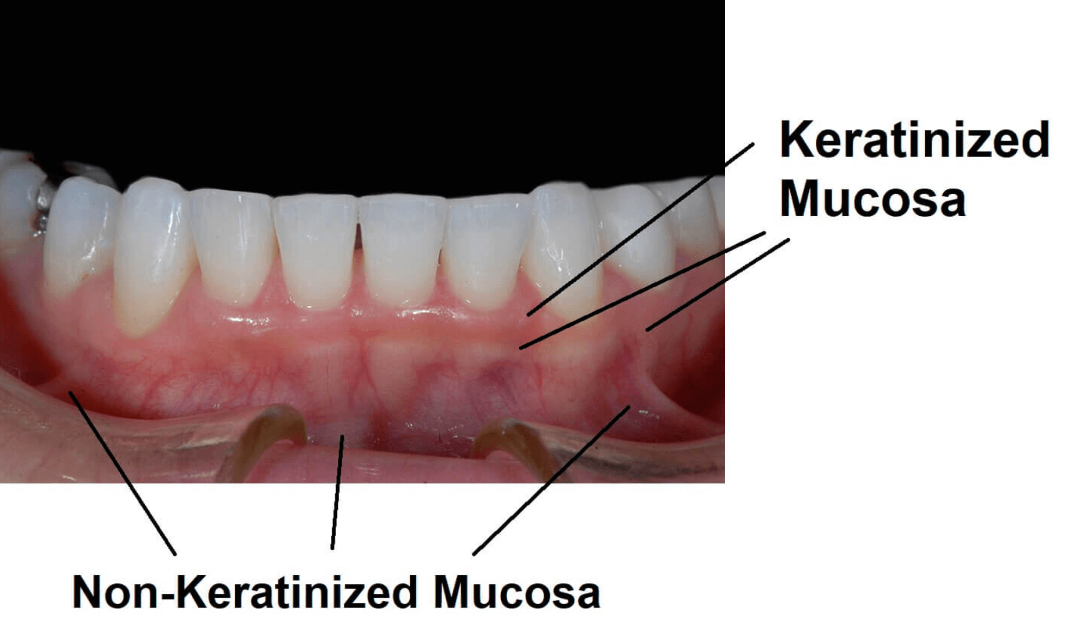 Dental Implant Courses UK-learn from the experts | Dental Iceberg