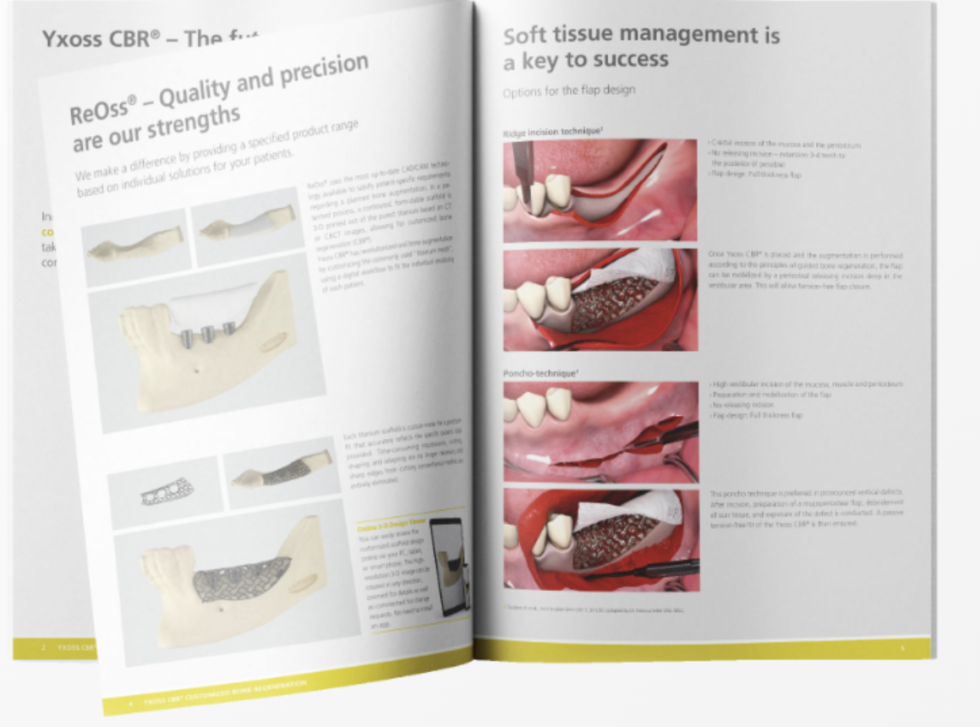Yxoss mesh - Customised bone regeneration Course | Dental Iceberg