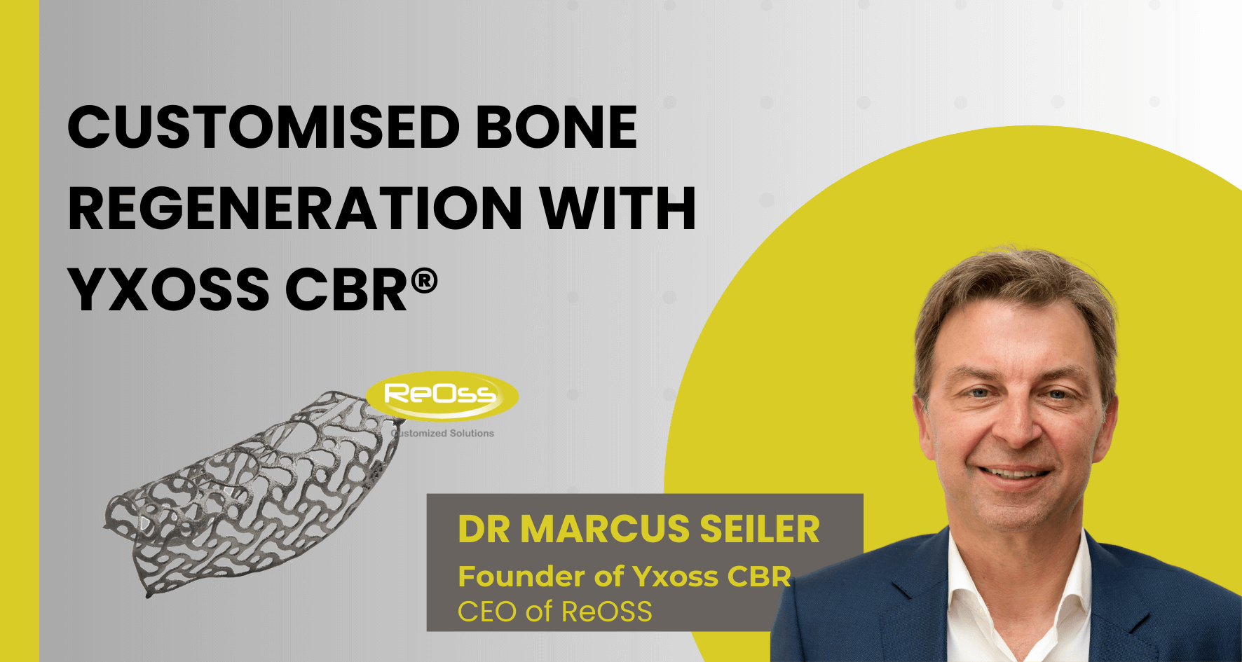 Yxoss CBR - Customised bone regeneration Course | Dental Iceberg